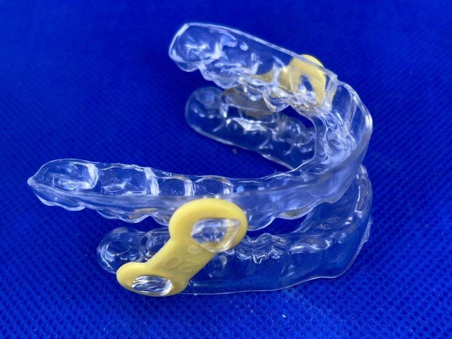 Orthodontic Appliances for Therapy ☑️ CD Ortho Studio