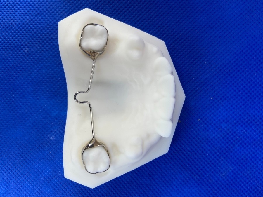 Orthodontic Appliances for Space Maintenance ☑️ CD Ortho Studio